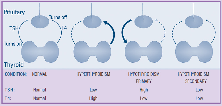 Hyperthyroidism American Thyroid Association